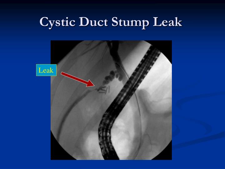PPT - ERCP & Fluoro Quiz PowerPoint Presentation - ID:6818168