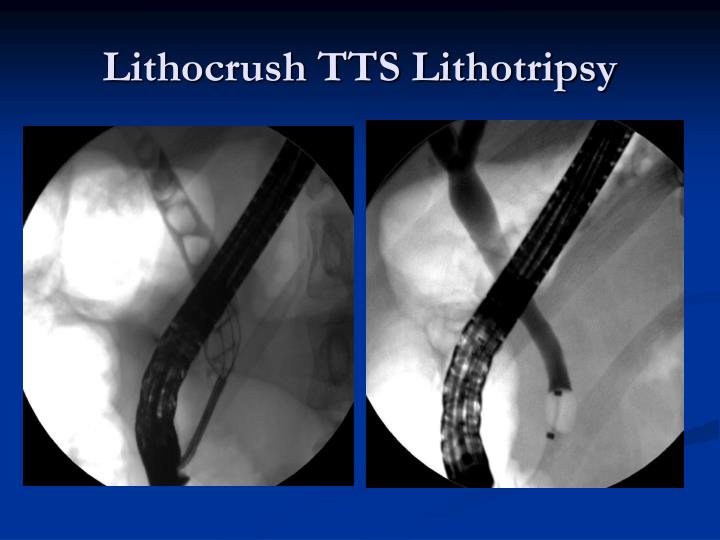 PPT - ERCP & Fluoro Quiz PowerPoint Presentation - ID:6818168