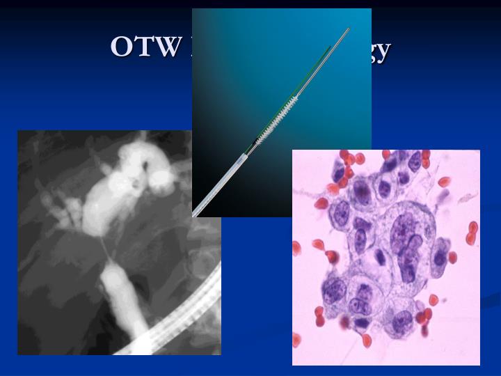 PPT - ERCP & Fluoro Quiz PowerPoint Presentation - ID:6818168