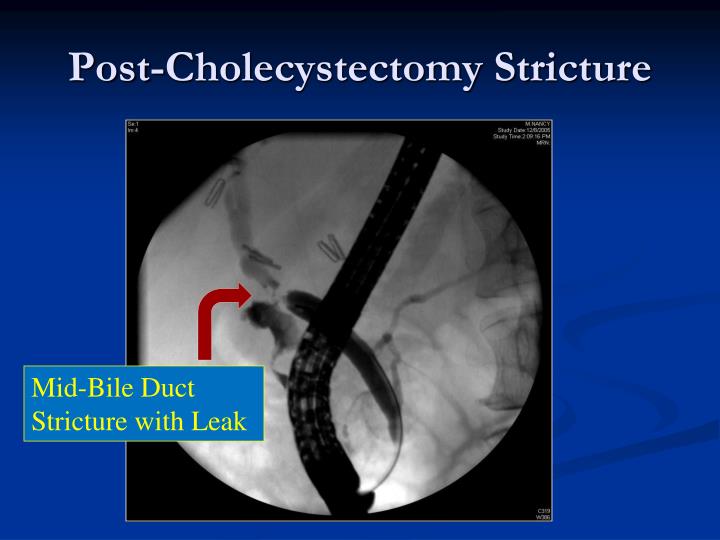 PPT - ERCP & Fluoro Quiz PowerPoint Presentation - ID:6818168