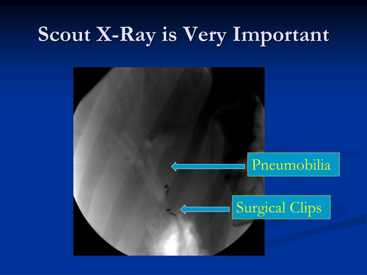 PPT - ERCP & Fluoro Quiz PowerPoint Presentation - ID:6818168