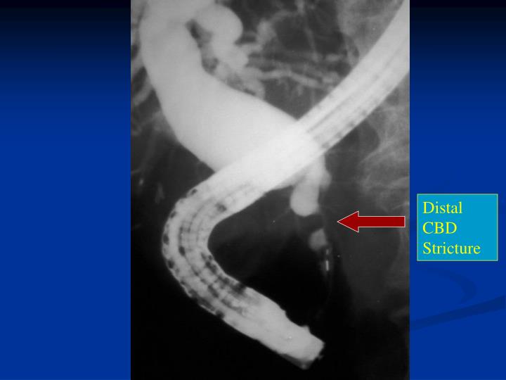 PPT - ERCP & Fluoro Quiz PowerPoint Presentation - ID:6818168