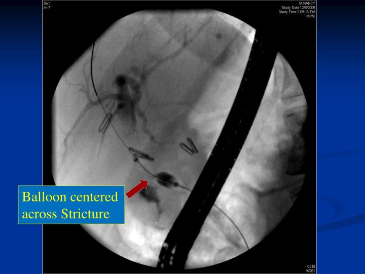 PPT - ERCP & Fluoro Quiz PowerPoint Presentation - ID:6818168