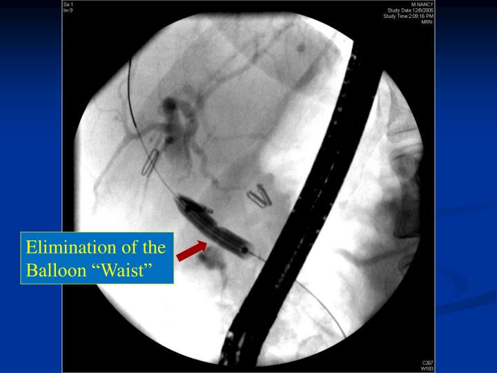 PPT - ERCP & Fluoro Quiz PowerPoint Presentation - ID:6818168