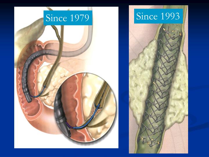 PPT - ERCP & Fluoro Quiz PowerPoint Presentation - ID:6818168