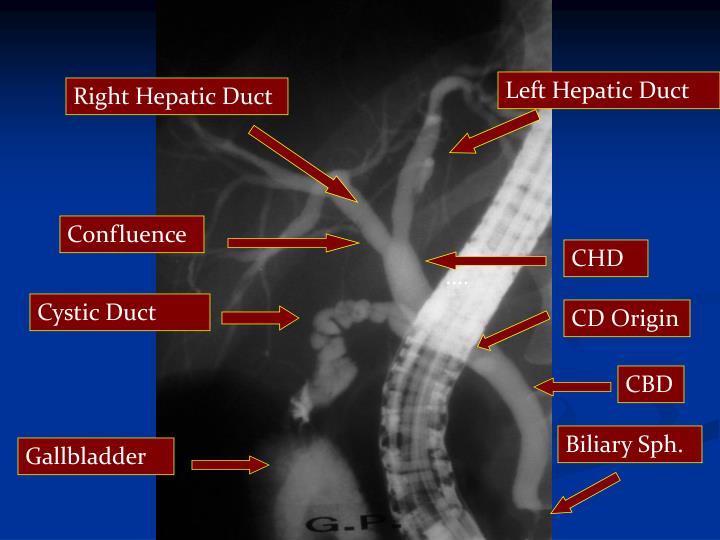 PPT - ERCP & Fluoro Quiz PowerPoint Presentation - ID:6818168