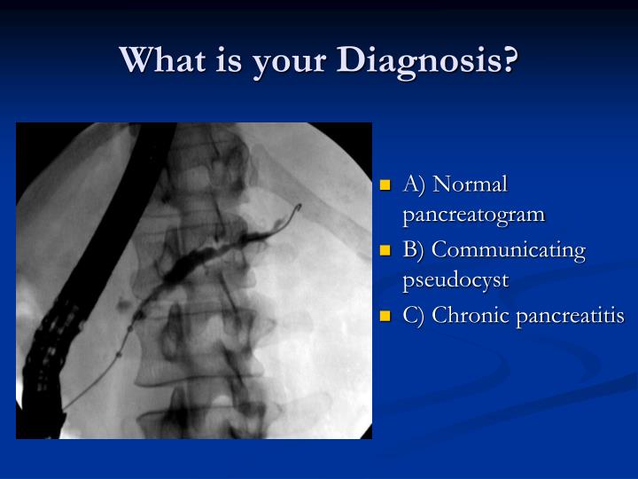 PPT - ERCP & Fluoro Quiz PowerPoint Presentation - ID:6818168