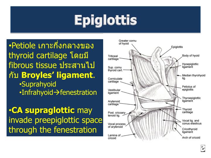 PPT - Conservation laryngeal surgery PowerPoint Presentation - ID:6825162
