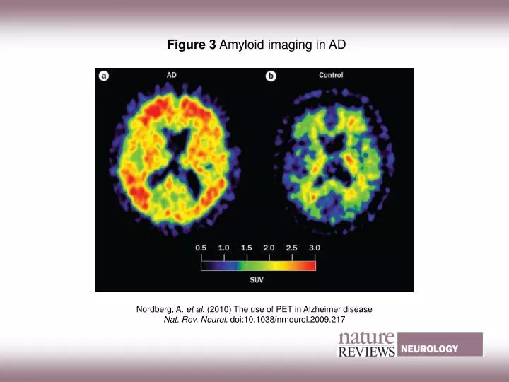 PPT - Figure 3 Amyloid imaging in AD PowerPoint Presentation, free ...
