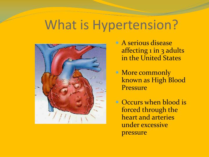 PPT - Agents to Treat Hypertension: PowerPoint Presentation - ID:6838625