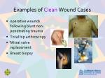 PPT - Wound Classification PowerPoint Presentation - ID:6859010