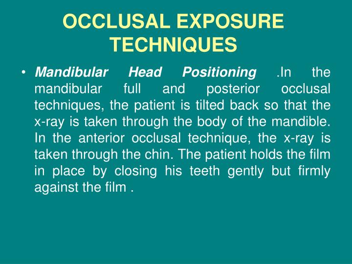 PPT - OCCLUSAL EXPOSURE TECHNIQUES PowerPoint Presentation - ID:6862351