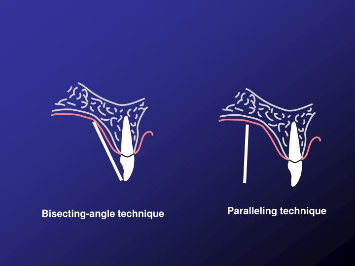 PPT - Intraoral Radiographic Techniques PowerPoint Presentation - ID ...
