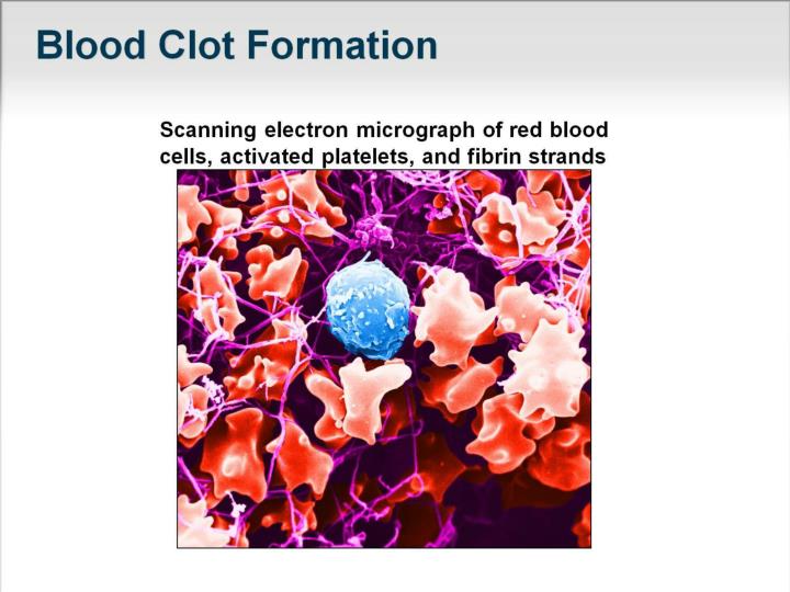 PPT - Blood Clot Formation PowerPoint Presentation - ID:6862876