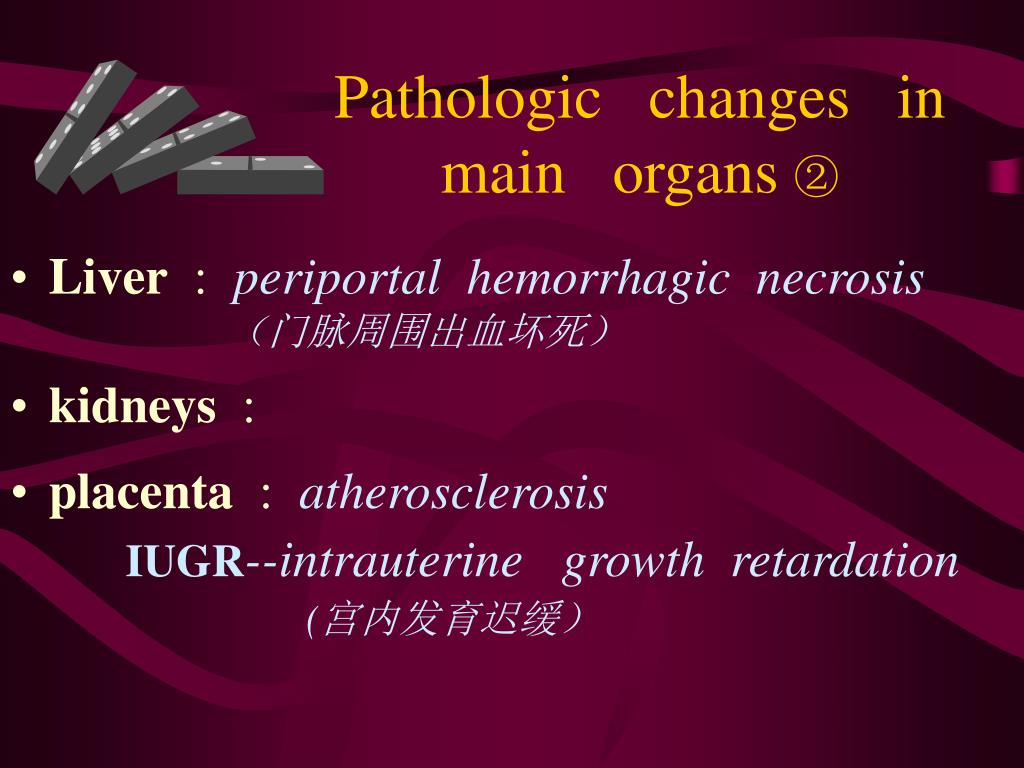 PPT - Pregnancy-induced hypertension syndrome (PIH) PowerPoint ...