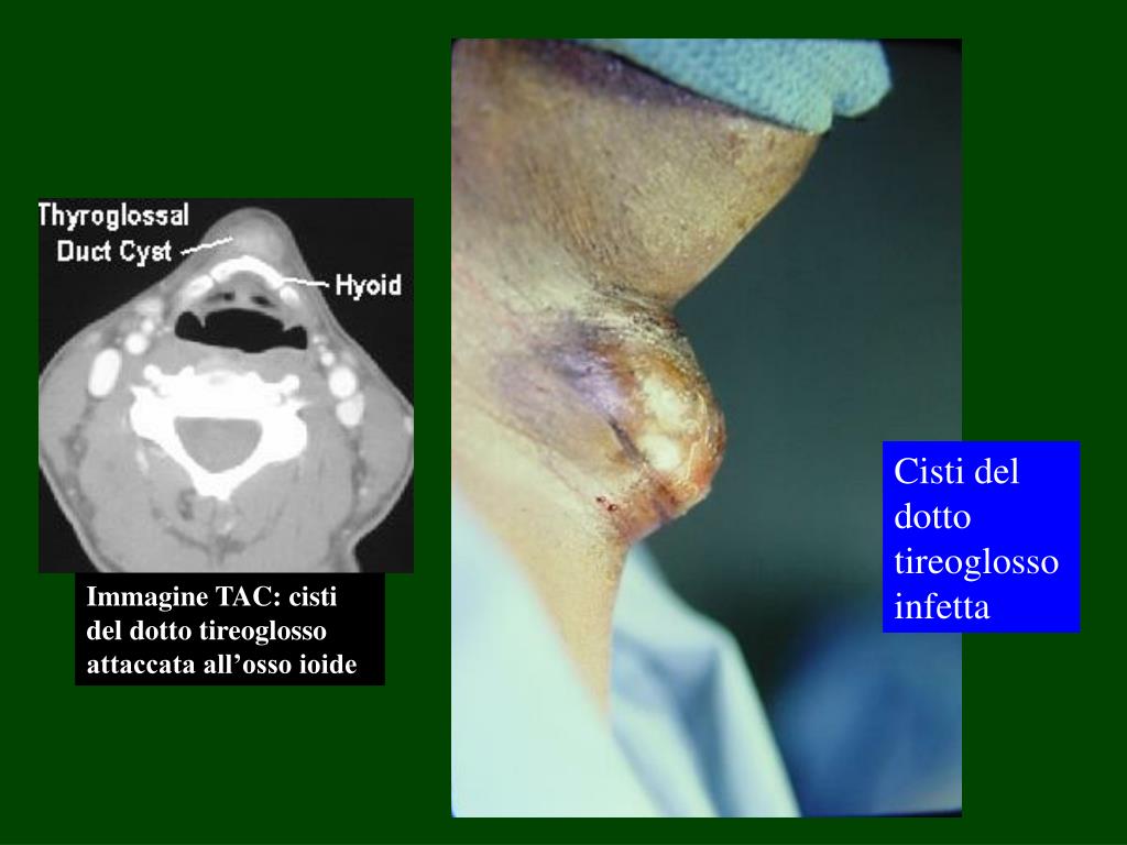 PPT - LEZIONI DI CLINICA CHIRURGICA GENERALE PowerPoint Presentation ...
