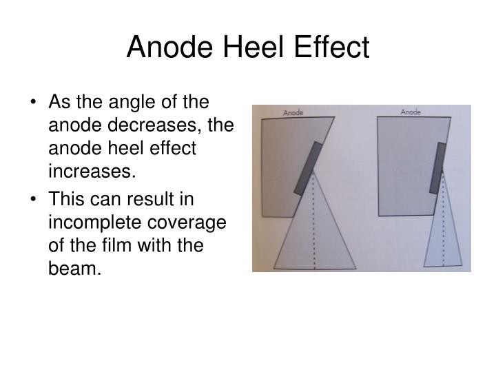 PPT - Chapter 9 The X-ray Machine PowerPoint Presentation - ID:6869278