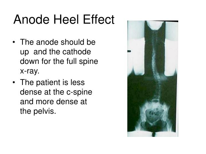 PPT - Chapter 9 The X-ray Machine PowerPoint Presentation - ID:6869278