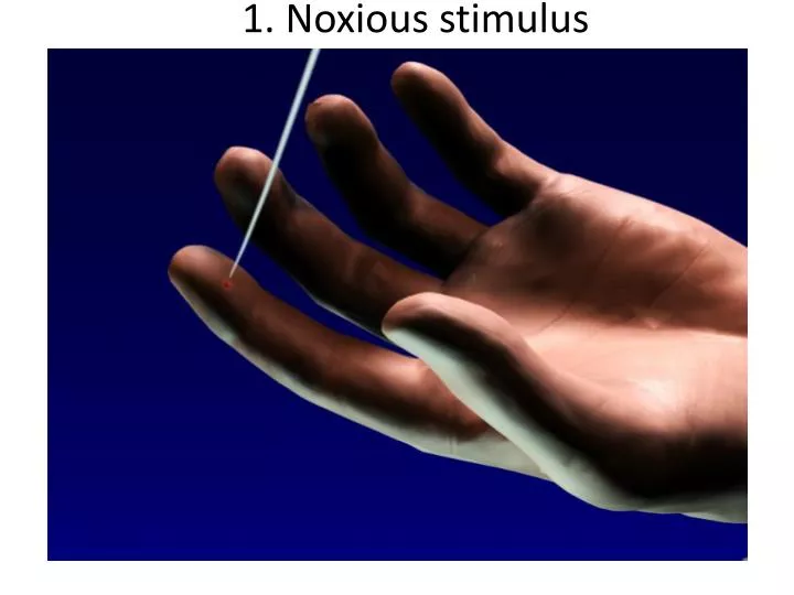 PPT - 1. Noxious stimulus PowerPoint Presentation, free download - ID ...