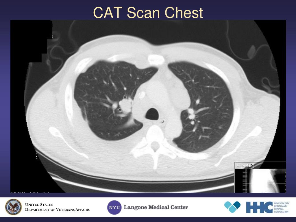 PPT - NYU Medicine Grand Rounds Clinical Vignette PowerPoint ...