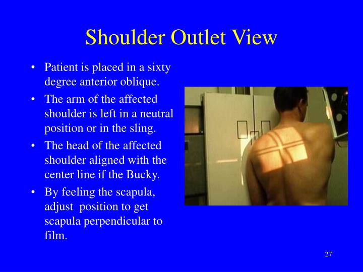 PPT - 14.1 Shoulder Radiography PowerPoint Presentation - ID:6870515