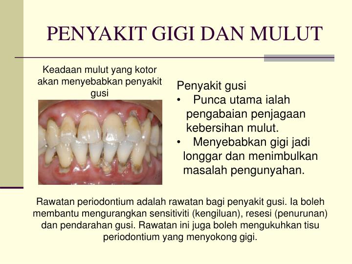 Ppt Gigi Jenis Penyakit Dan Rawatan Powerpoint Presentation Id