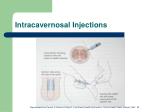 PPT - Erectile Dysfunction PowerPoint Presentation - ID:6871961