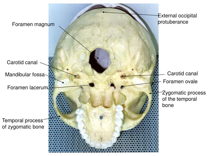 PPT - Incisive foramen PowerPoint Presentation - ID:6875522