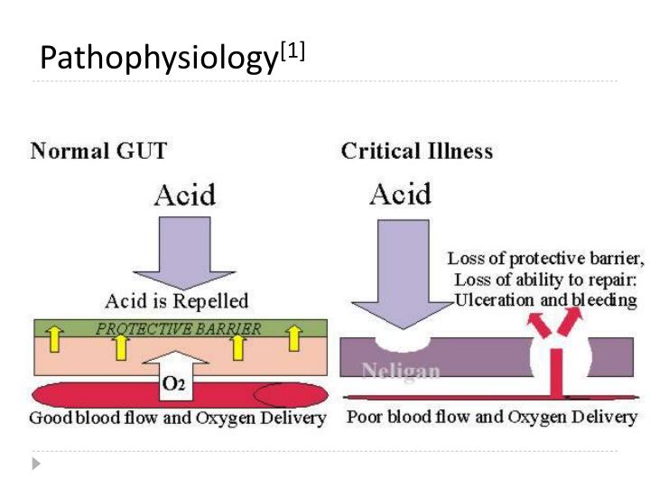 PPT - GI Prophylaxis PowerPoint Presentation - ID:6878649
