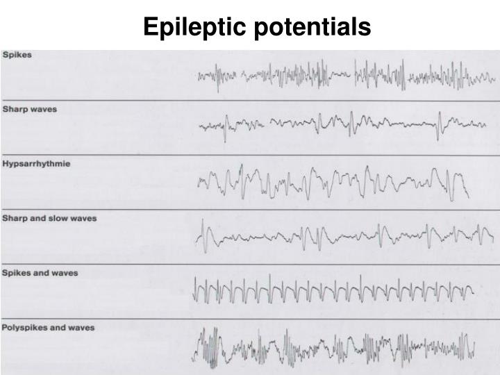 PPT - 1 . Electroencephalography Definition PowerPoint Presentation ...