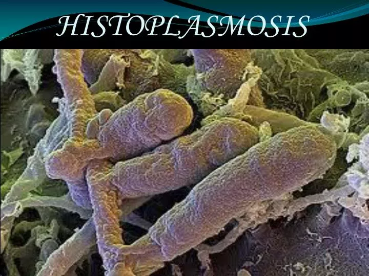 PPT - HISTOPLASMOSIS PowerPoint Presentation, free download - ID:6879713