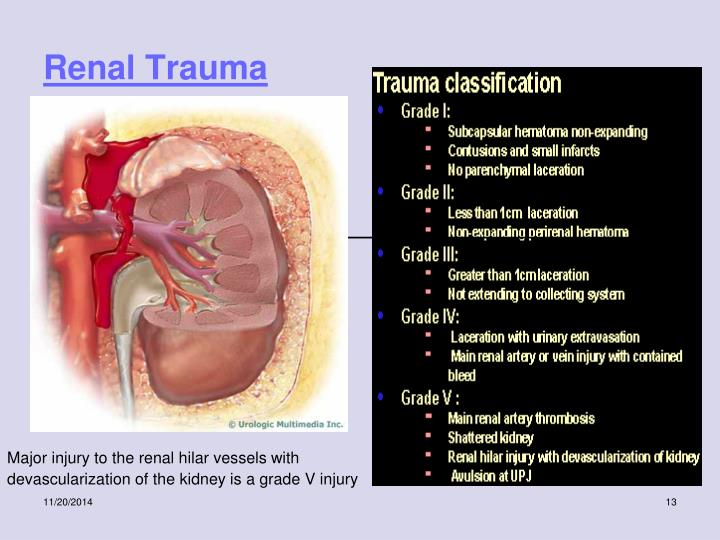 PPT - Renal A & P -excellent site- renal pathophysiology PowerPoint ...