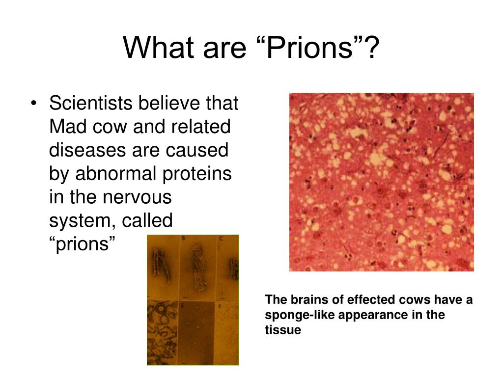 Ppt Mad Cow Disease Powerpoint Presentation Free Download Id 6884006