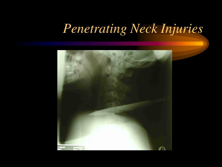 PPT - Penetrating Neck Injuries PowerPoint Presentation - ID:6887578