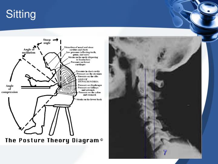 PPT - Ergonomics, Biomechanics and Injury Prevention PowerPoint ...