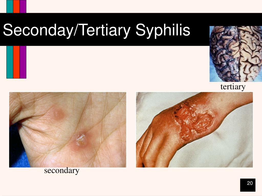 PPT - UROGENITAL AND SEXUALLY TRANSMITTED DISEASES PowerPoint ...