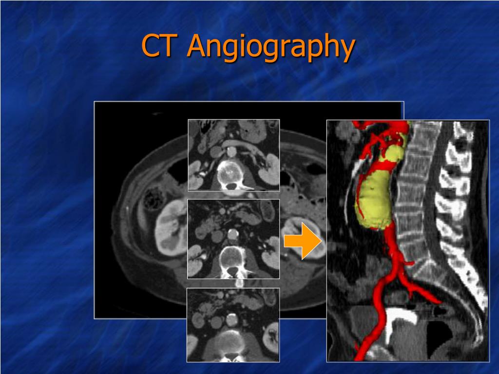 PPT - Vascular Surgery - 101 Vascular Assessment and PAD PowerPoint ...