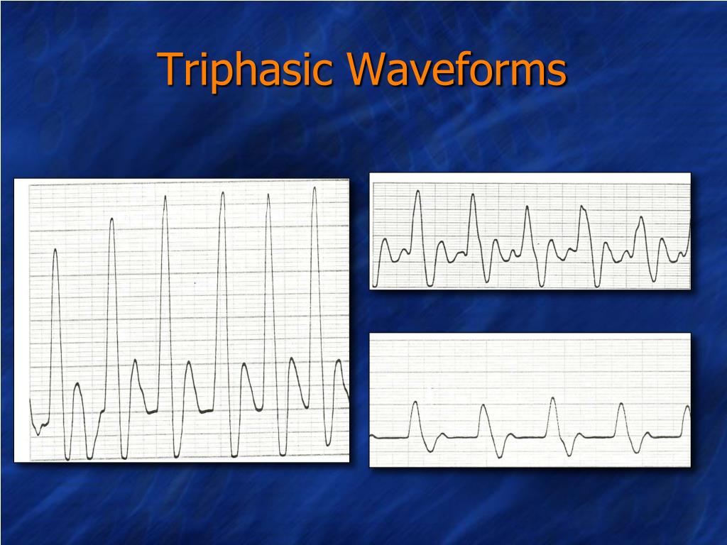 PPT - Vascular Surgery - 101 Vascular Assessment and PAD PowerPoint ...