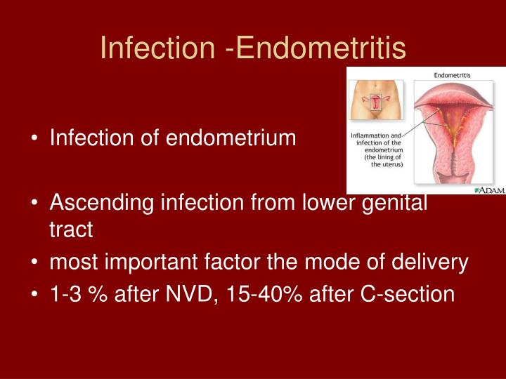 PPT - Postpartum complications PowerPoint Presentation - ID:6894855