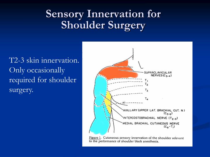 PPT - Supraclavicular and Interscalene Blocks PowerPoint Presentation ...