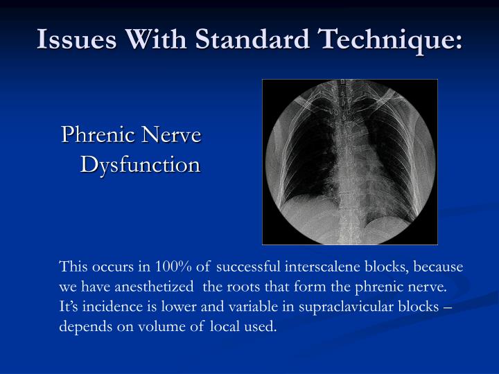 PPT - Supraclavicular and Interscalene Blocks PowerPoint Presentation ...