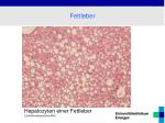 PPT - Lebererkrankungen PowerPoint Presentation - ID:6903850