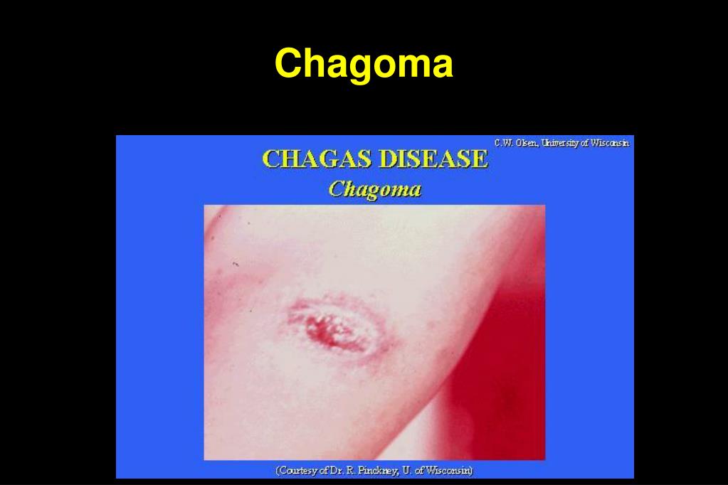 PPT - BLOOD, HEMATOPOIETIC, AND LYMPHATIC PARASITIC INFECTIONS ...