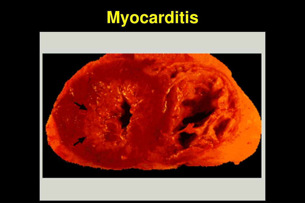 PPT - BLOOD, HEMATOPOIETIC, AND LYMPHATIC PARASITIC INFECTIONS ...