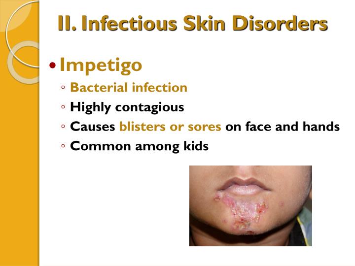 PPT - Integumentary System Part 2: Skin Disorders PowerPoint ...
