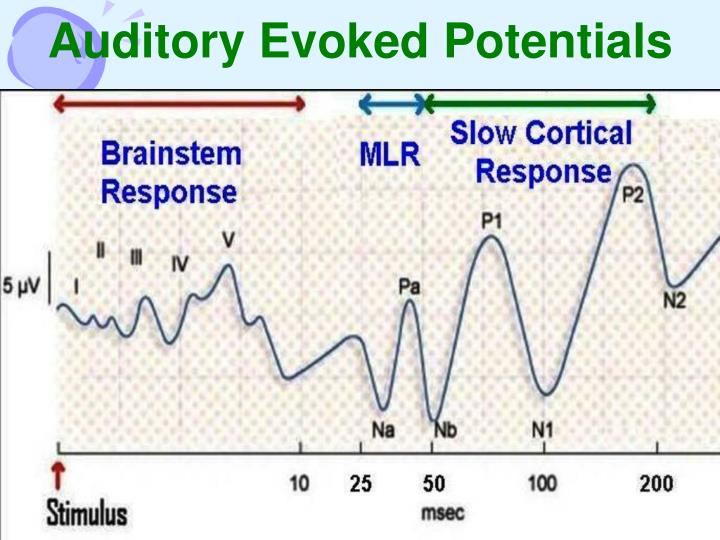 PPT - Audiometry PowerPoint Presentation - ID:6912897