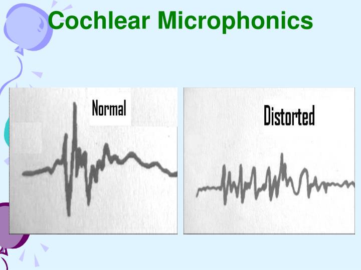 PPT - Audiometry PowerPoint Presentation - ID:6912897