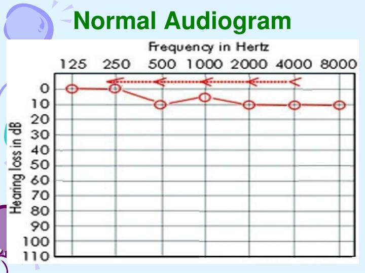 PPT - Audiometry PowerPoint Presentation - ID:6912897
