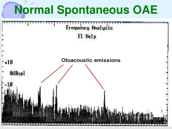PPT - Audiometry PowerPoint Presentation - ID:6912897
