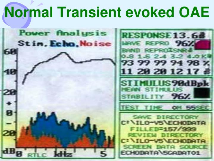 PPT - Audiometry PowerPoint Presentation - ID:6912897